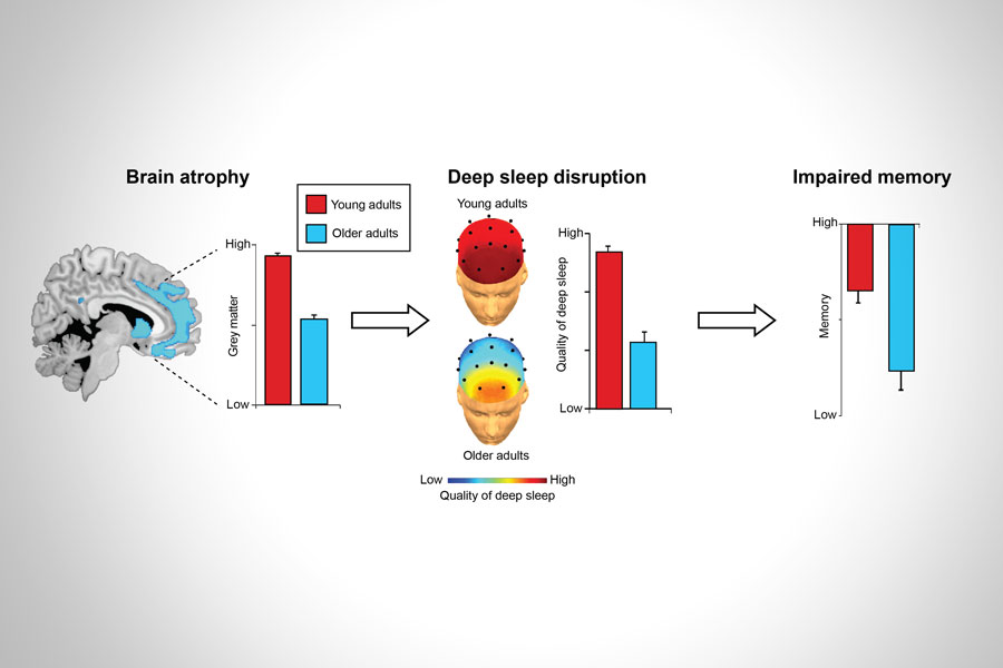 Sleep and memory loss in aging | WELLNESS OPTIONS